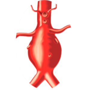 Patients – Nectero Medical